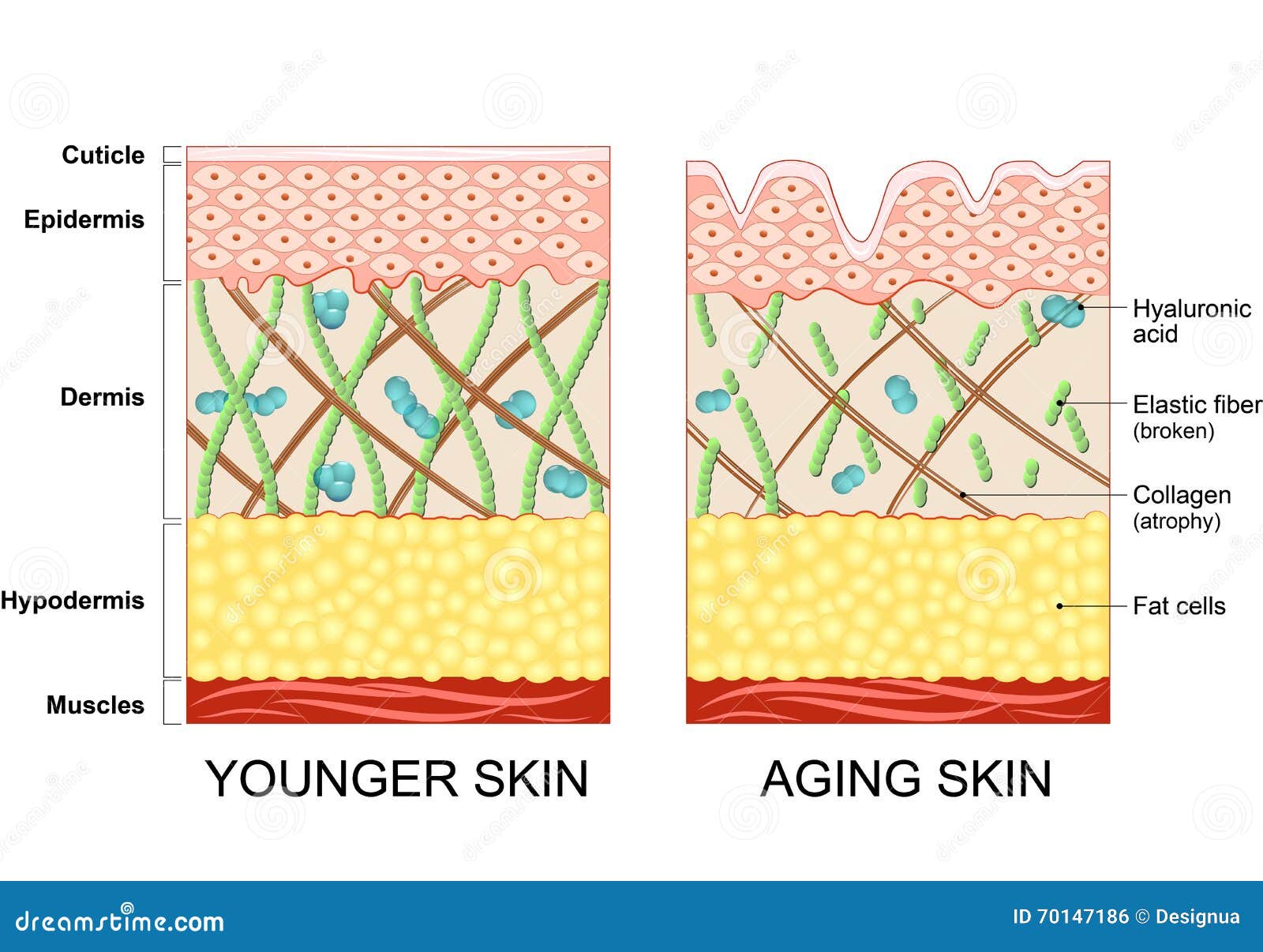 Younger Skin and Older Skin Stock Vector - Illustration of fiber ...