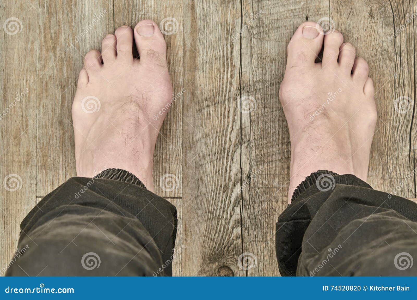 At Your Feet stock photo. Image of competition, competitive - 74520820