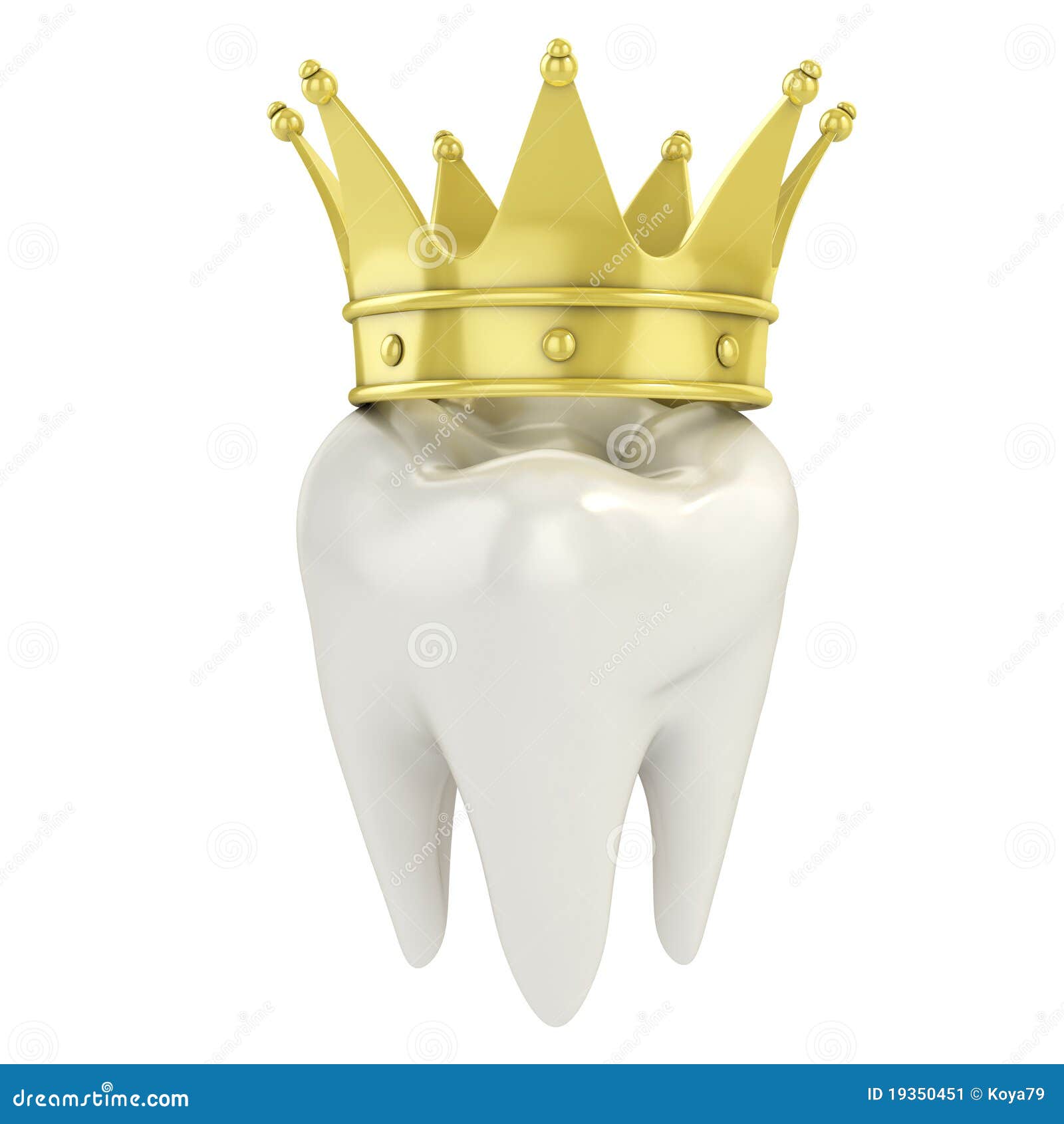 Zahn mit goldener Krone stock abbildung. Illustration von digital ...