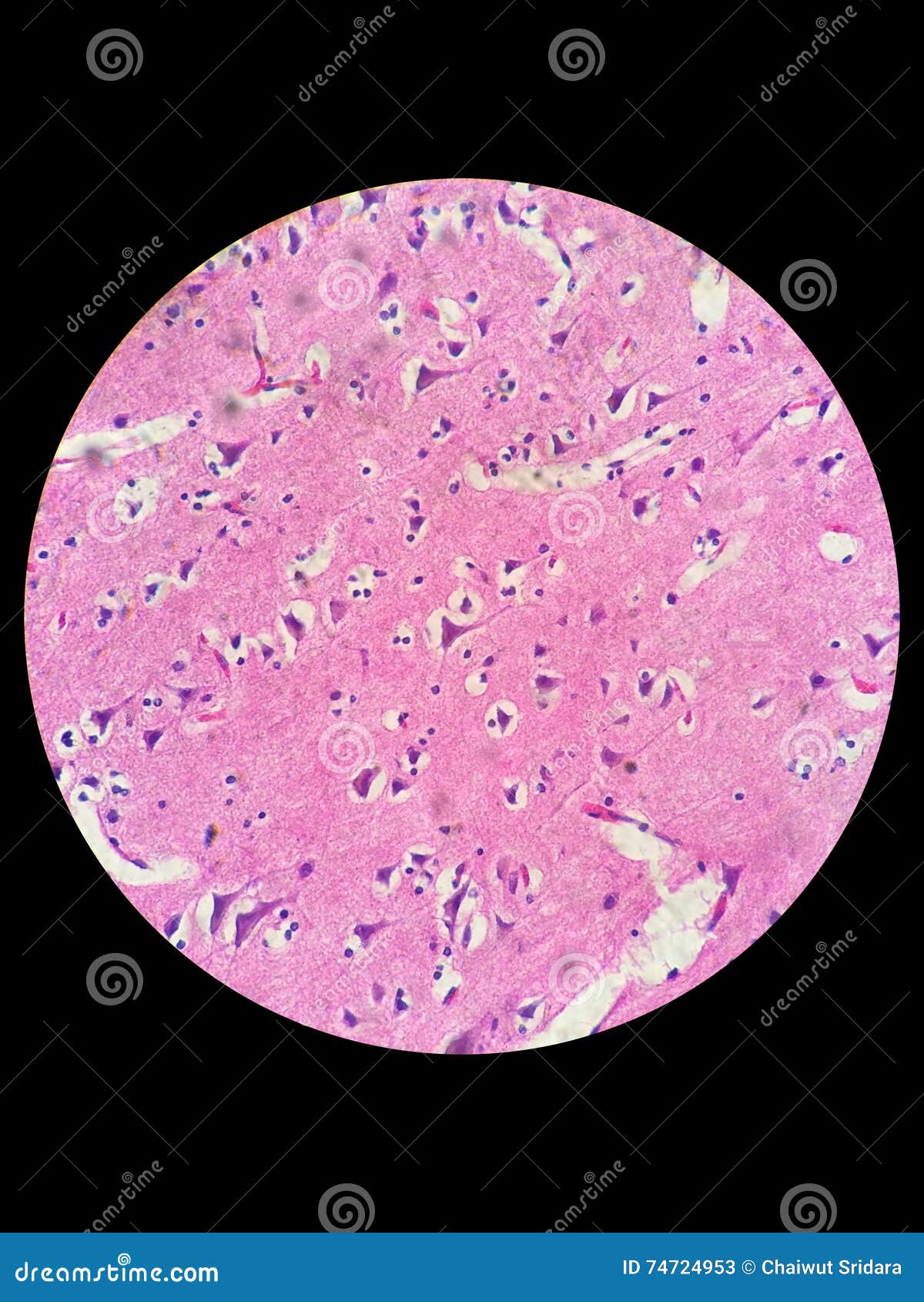 Zenuwcellen Onder Lichte Microscoop Stock Afbeelding - Image of ...