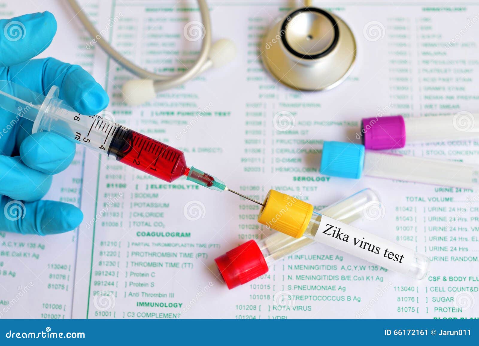 Zika virus test stock image. Image of mosquito, asthenia - 66172161