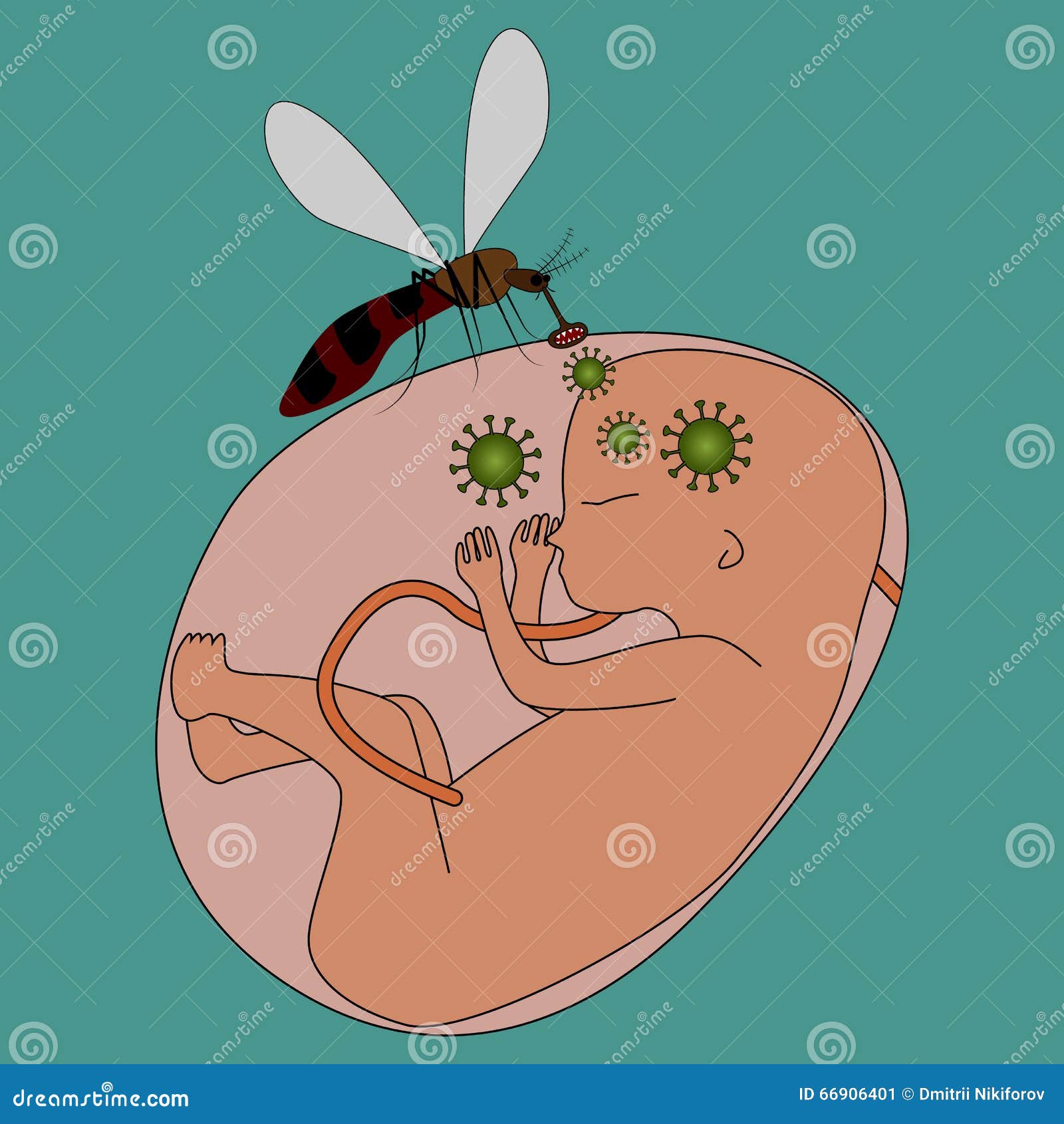 Zika Virus is Transmitted by the Bite of a Mosquito Stock Vector ...