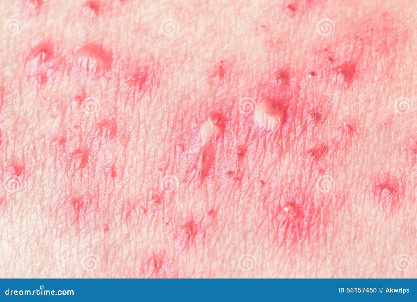 Zona (bardeaux) Photo stock - Image: 56157450