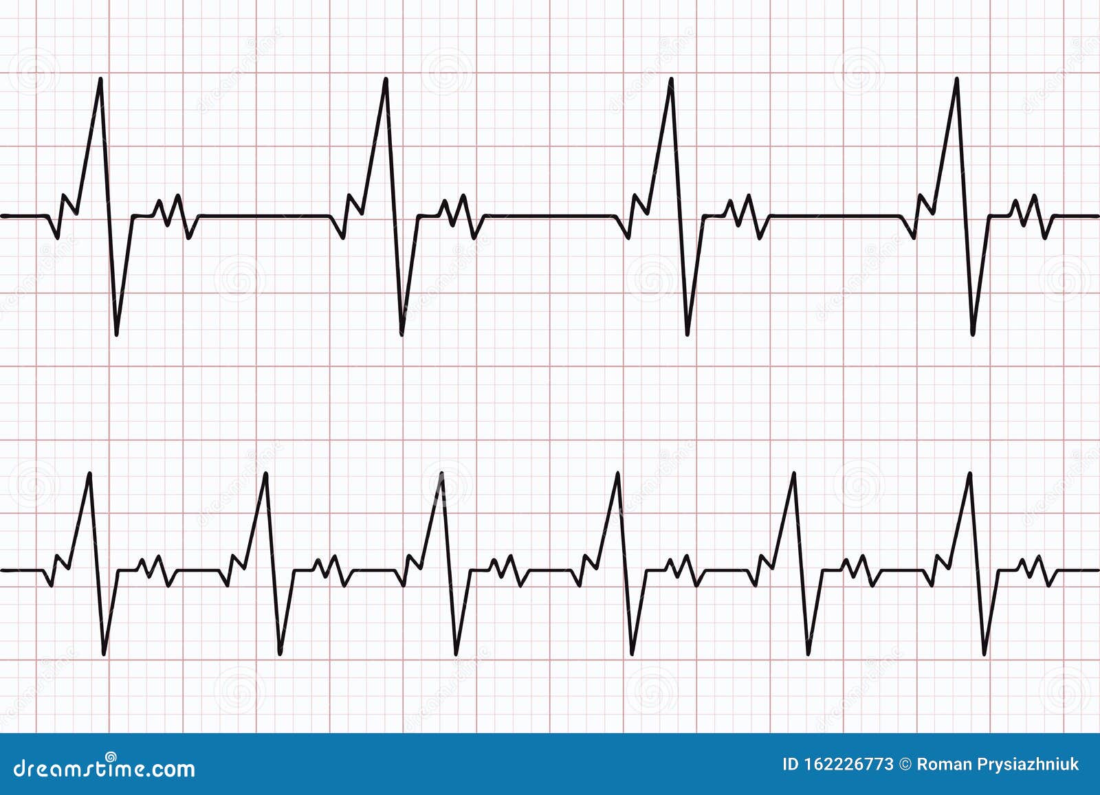 Electrocardiogram Paper With Normal ECG Cartoon Vector | CartoonDealer ... Electrocardiogram Paper With Normal ECG Cartoon Vector | CartoonDealer ...
